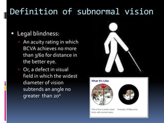 Princibles of low vision aids .pptx