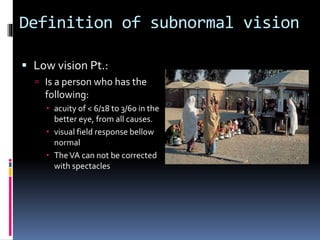 Princibles of low vision aids .pptx