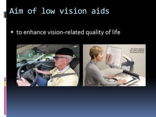 Princibles of low vision aids .pptx