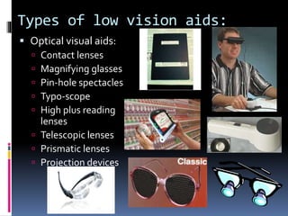 Princibles of low vision aids .pptx