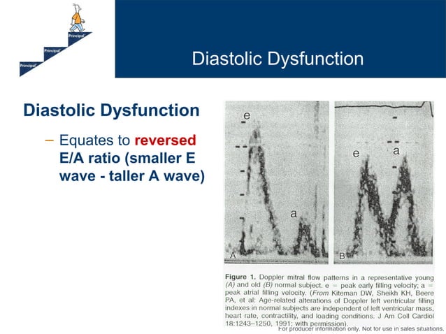 Principal basics of the echocardiogram diastolic dysfunction and left ...