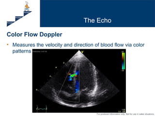 Principal basics of the echocardiogram diastolic dysfunction and left ...