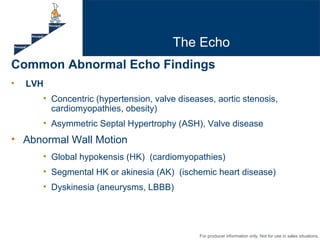 Principal basics of the echocardiogram diastolic dysfunction and left ...