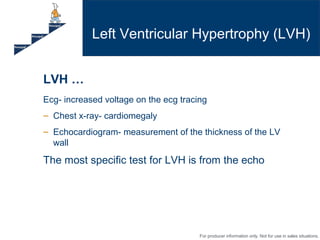 Principal basics of the echocardiogram diastolic dysfunction and left ...