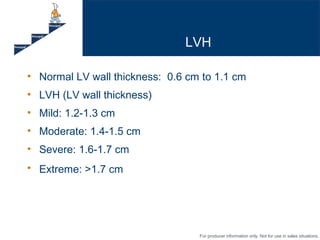 Principal basics of the echocardiogram diastolic dysfunction and left ...