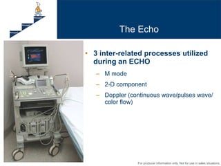 Principal basics of the echocardiogram diastolic dysfunction and left ...