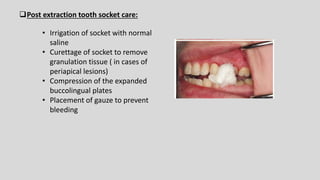 Principal of exotondia | PPTX | Dental Health | Diseases and Conditions