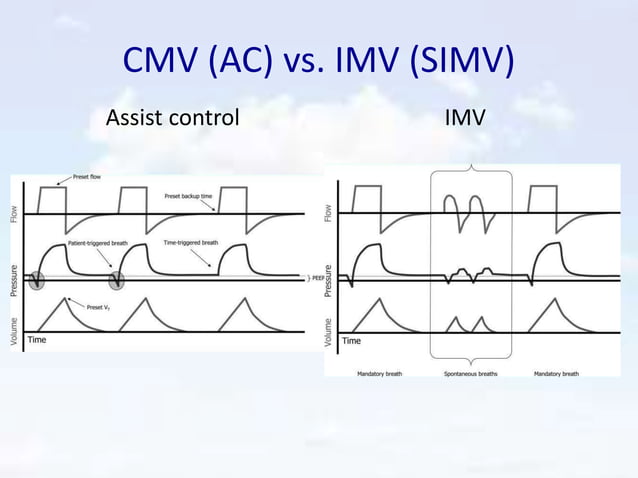 Principals of conventional positive pressure mechanical ventilation ...