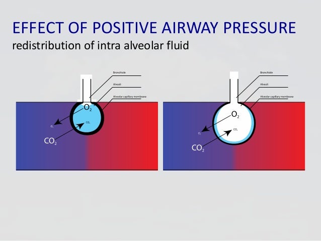 Principals of conventional positive pressure mechanical ventilation