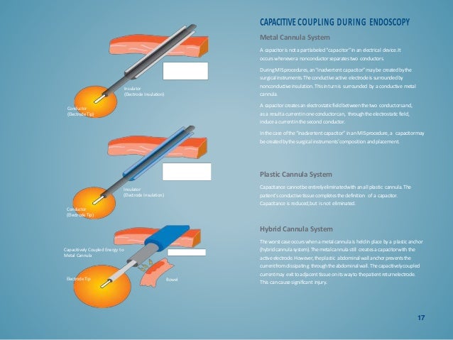 Principles in Electrosurgery