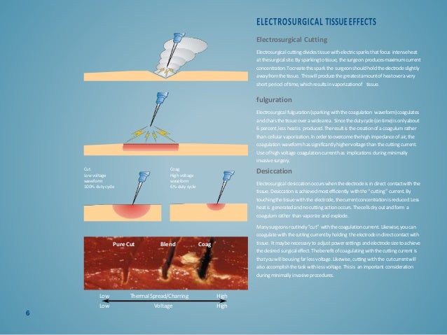 Principles in Electrosurgery