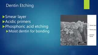 Principals of Bonding | PPT