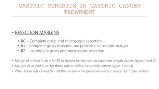 Principes of gastrectomies | PPTX