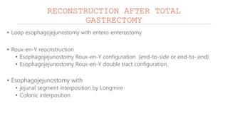 Principes of gastrectomies | PPTX
