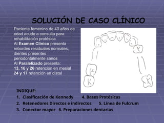 Principio de diseño de prótesis parcial removible | PPTX
