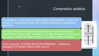 PRINCIPIOS BIOMECANICOS EN OSTEOSINTESIS.pptx