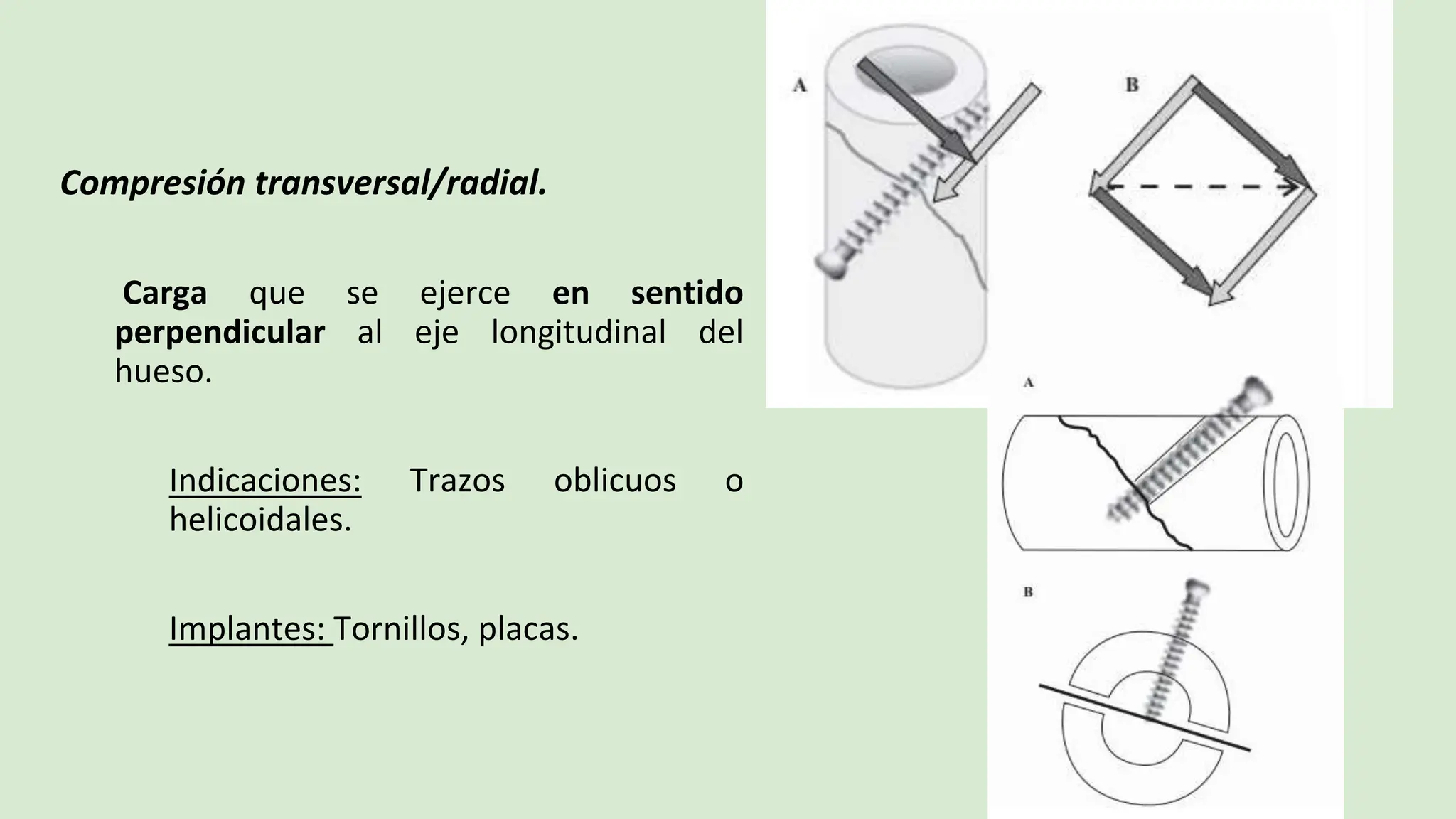 Principios Biomecánicos para el manejo quirurgico de fracturas | PPTX