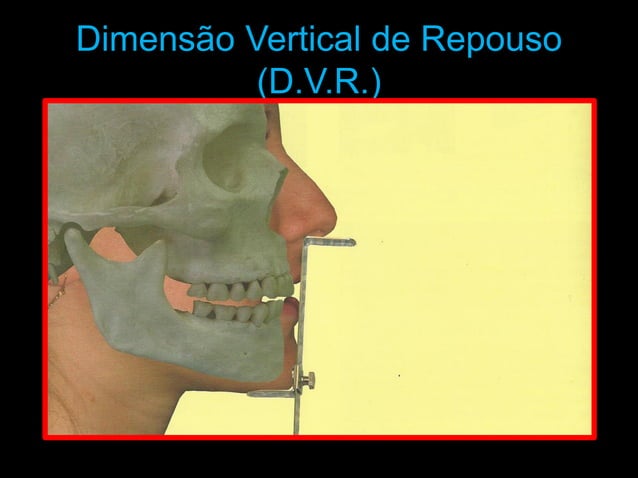 Principios de oclusão | PPT