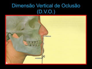 Principios de oclusão | PPT