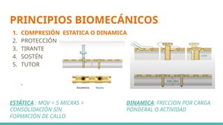 PRINCIPIOS DE OSTEOSINTESIS EN TRAUMATOLOGIA Y ORTOPEDIApptx | PPTX