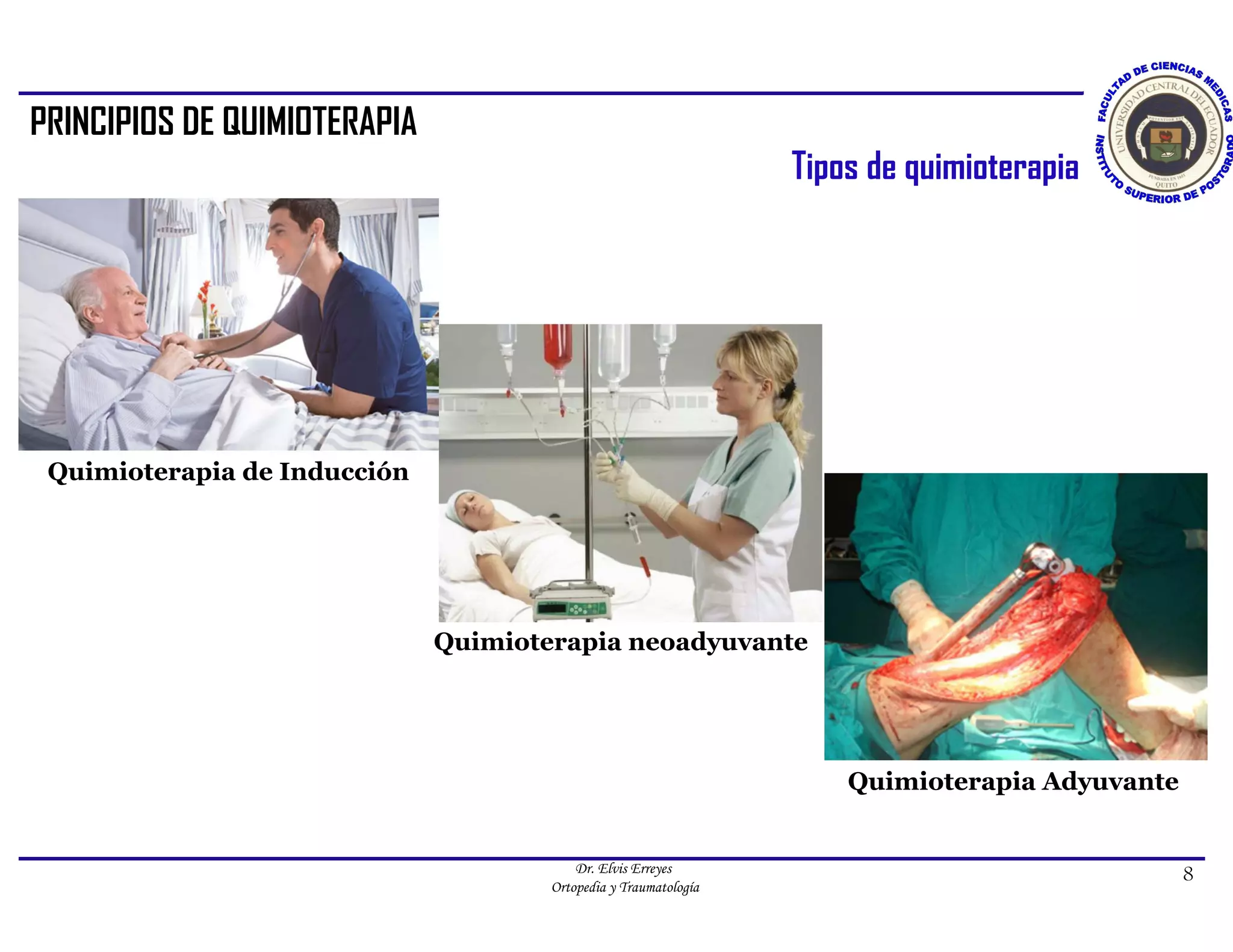 Principios de Quimioterapia Oncológica, E.E. | PDF