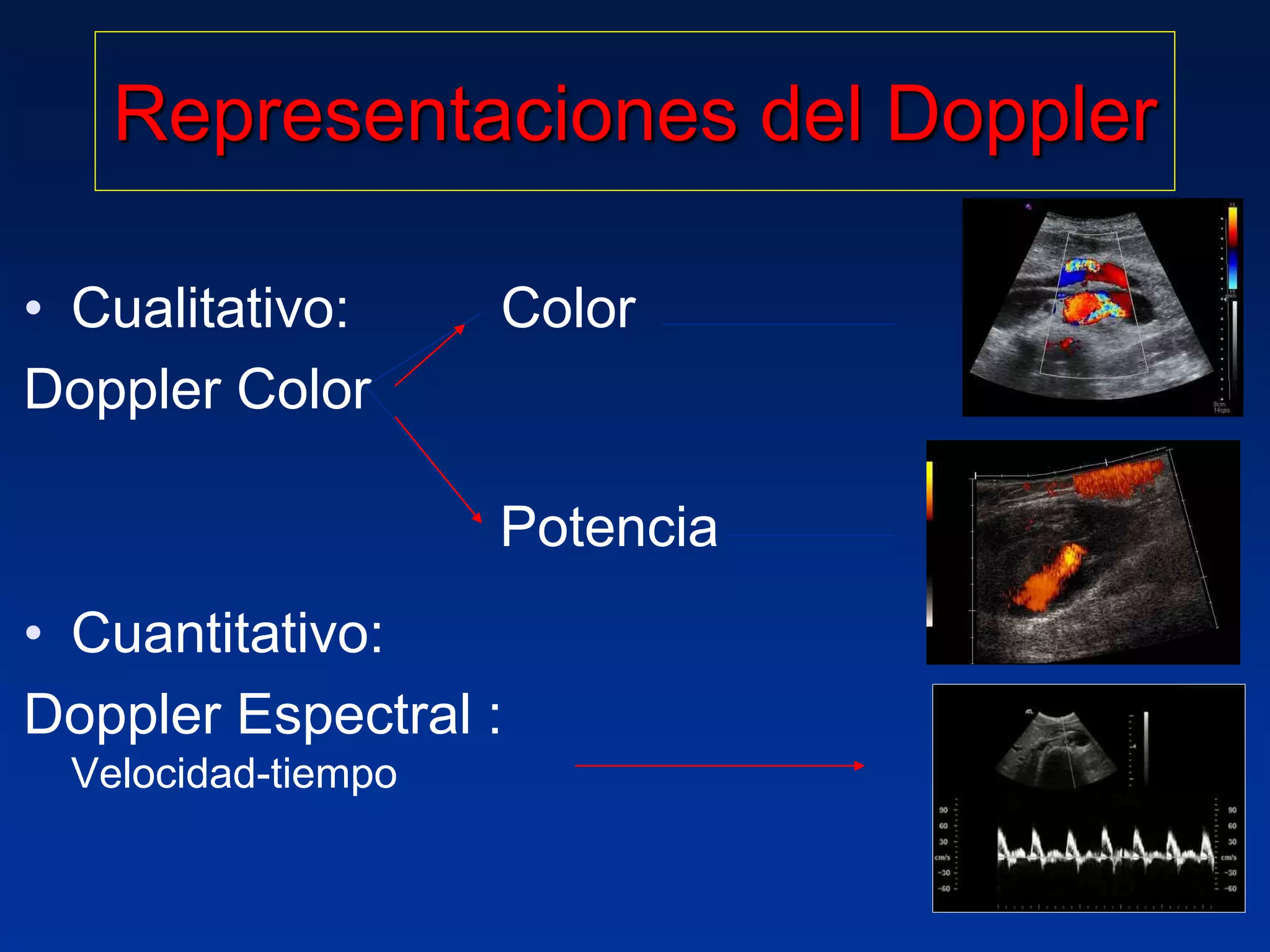 Principios Fisicos De Ecografia Doppler Pptx