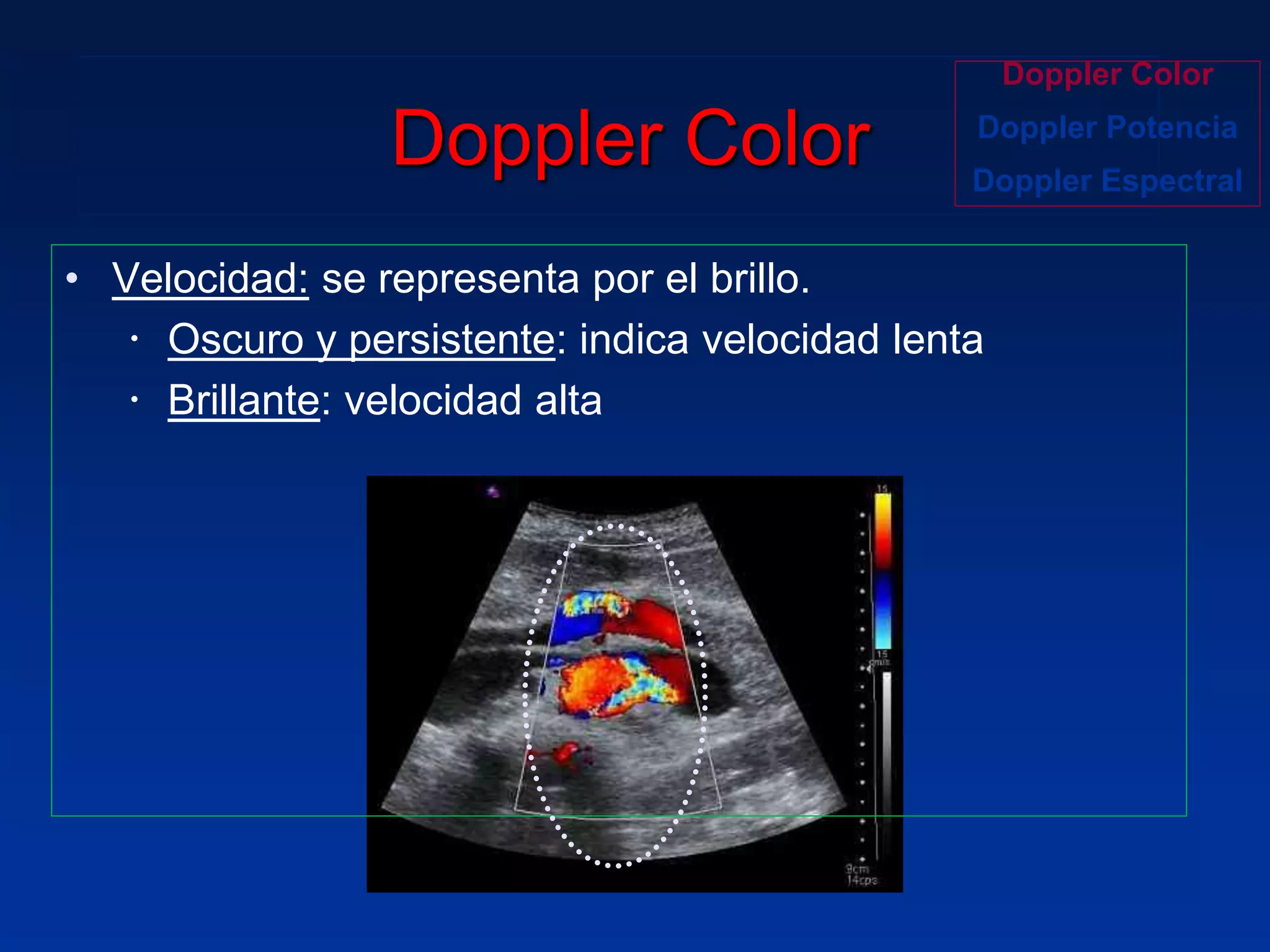 Principios fisicos de ecografia doppler | PPTX