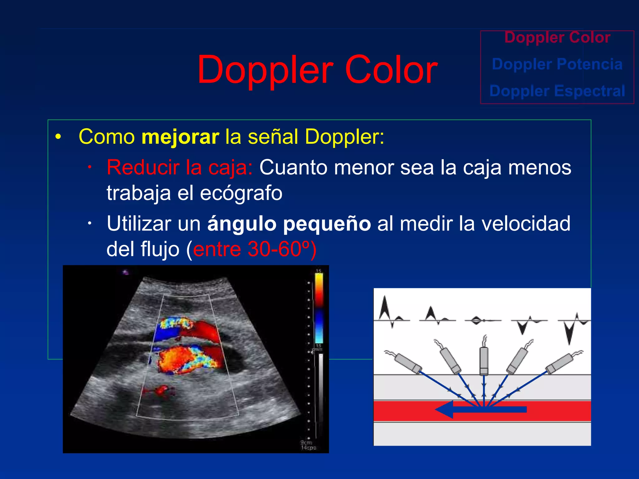 Principios Fisicos De Ecografia Doppler Pptx
