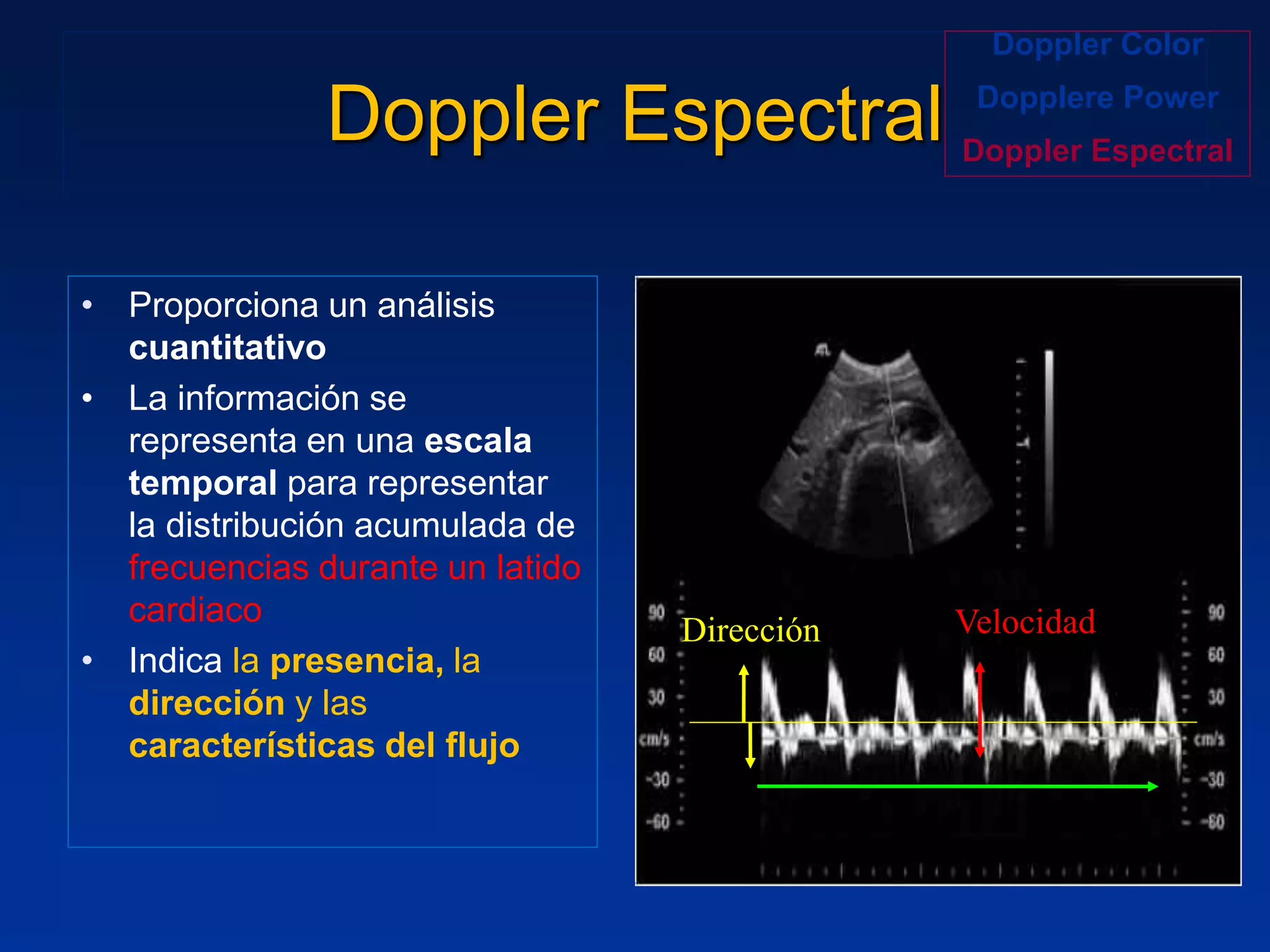 Principios Fisicos De Ecografia Doppler Pptx