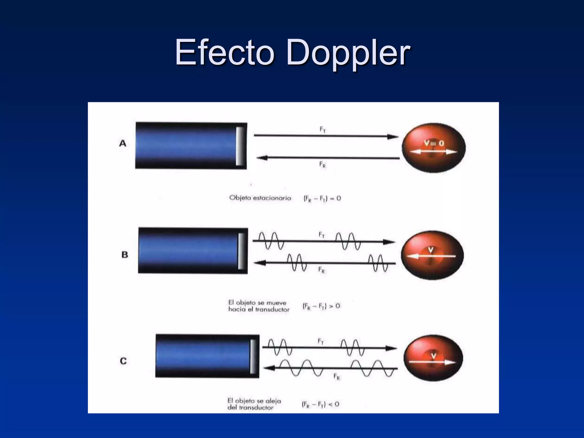 Principios Fisicos De Ecografia Doppler Pptx