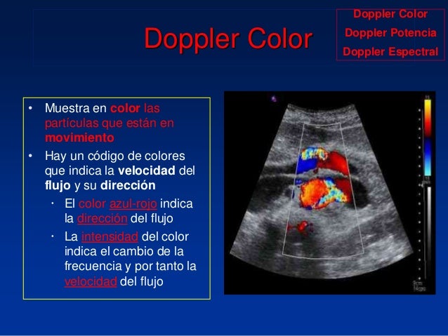 Principios fisicos de ecografia doppler