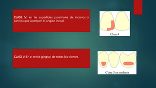 PRINCIPIOS PARA PREPARACION CAVITARIA 3.pptx