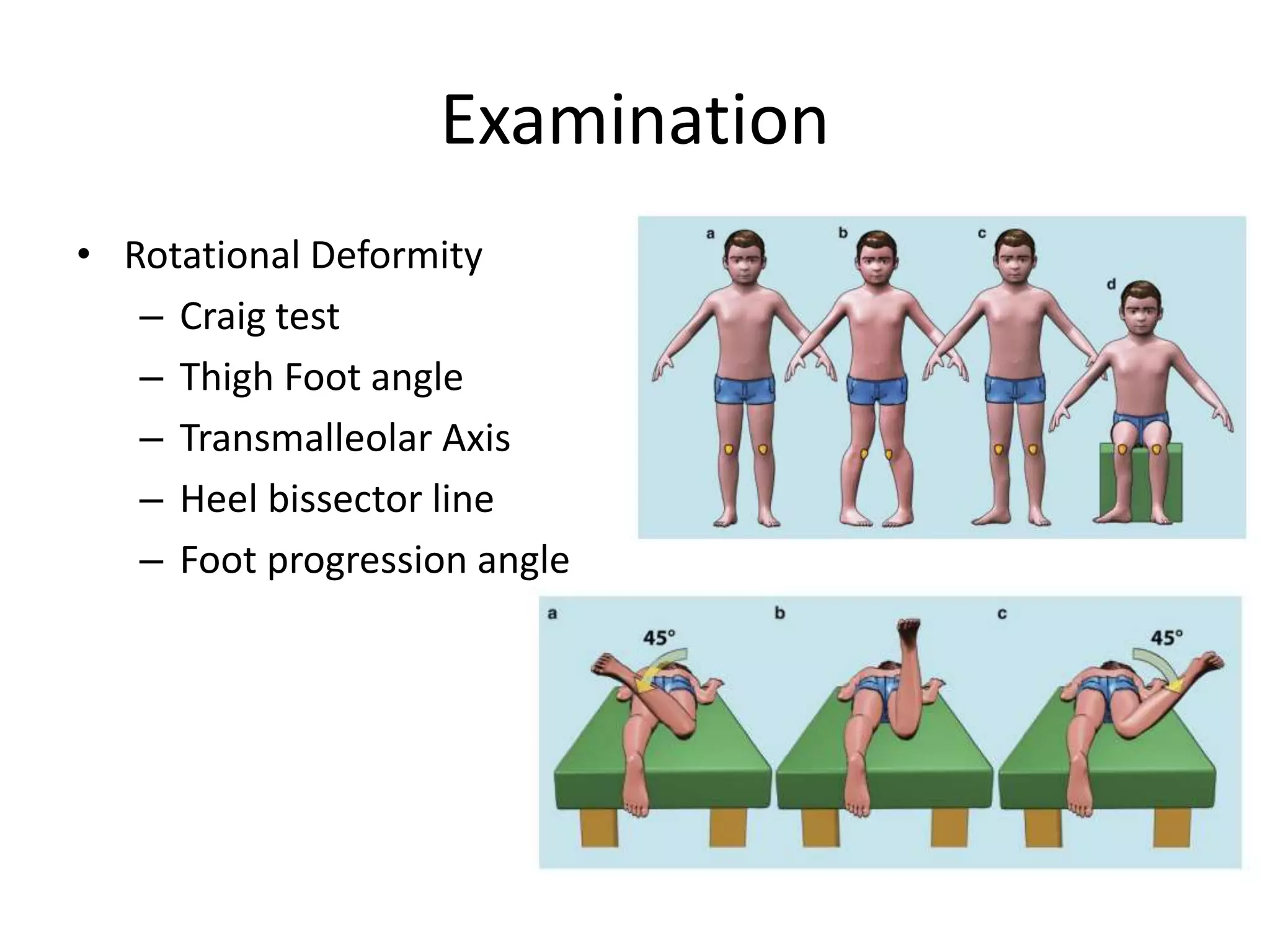 Principle of Deformity Correction in lower Limb | PPTX