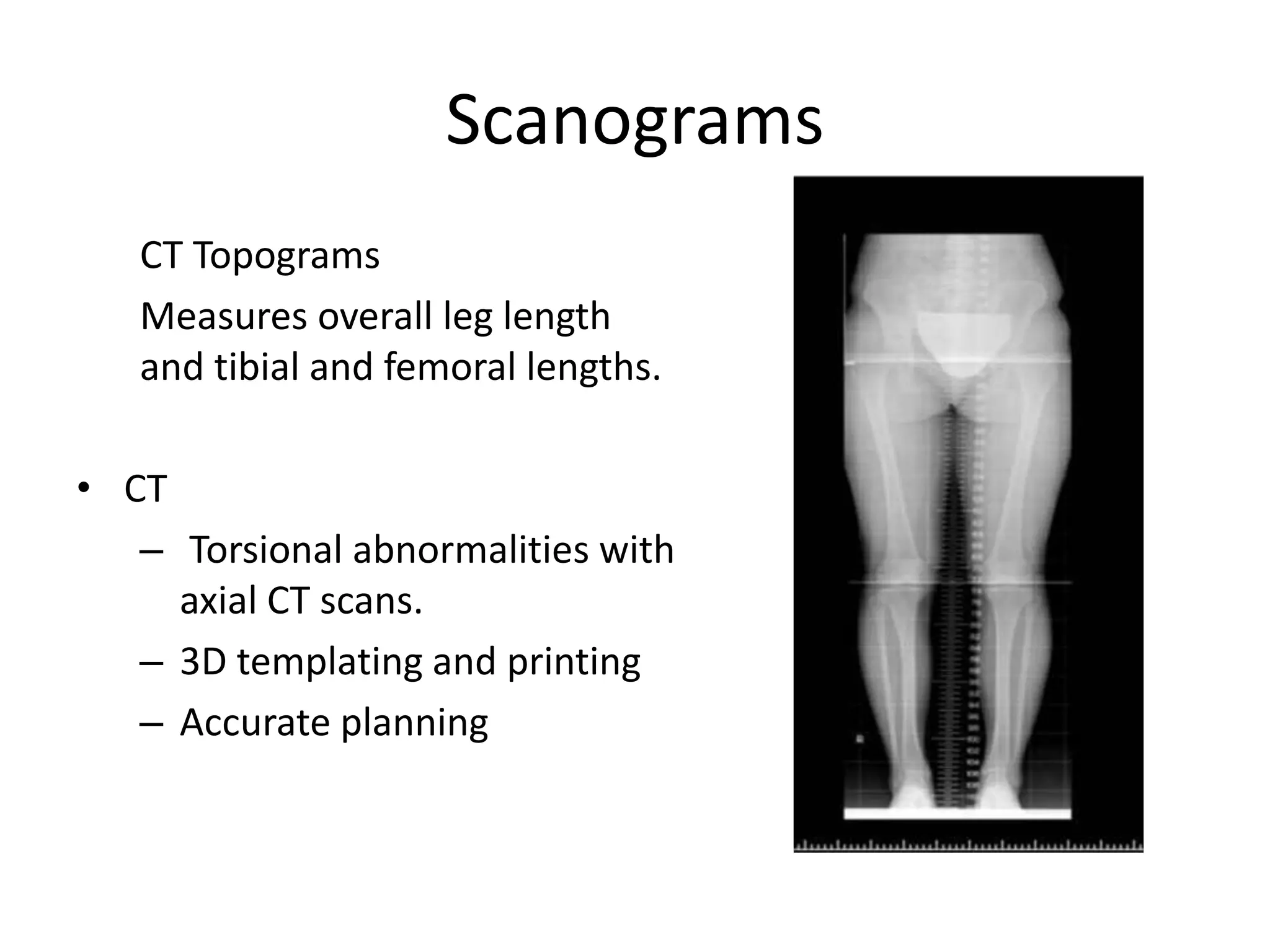 Principle of Deformity Correction in lower Limb | PPTX