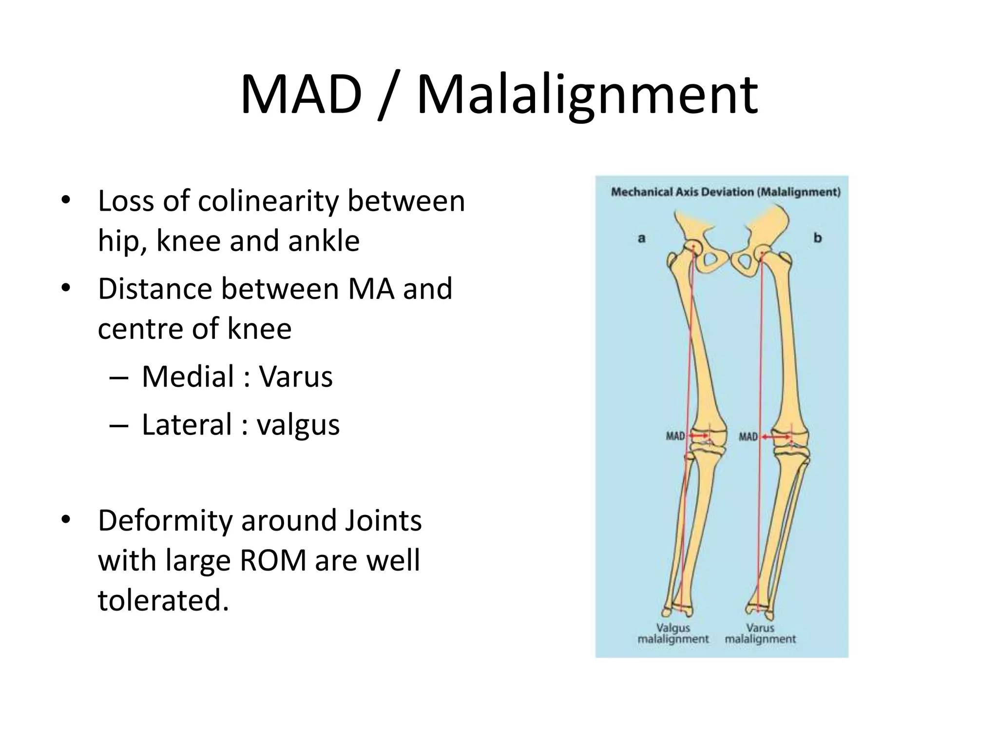 Principle of Deformity Correction in lower Limb | PPTX