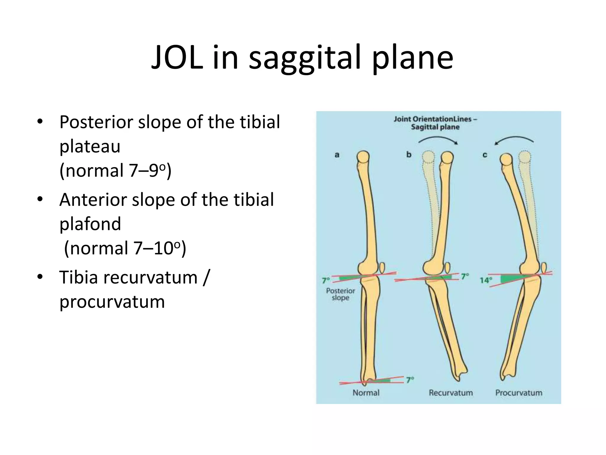 Principle of Deformity Correction in lower Limb | PPTX