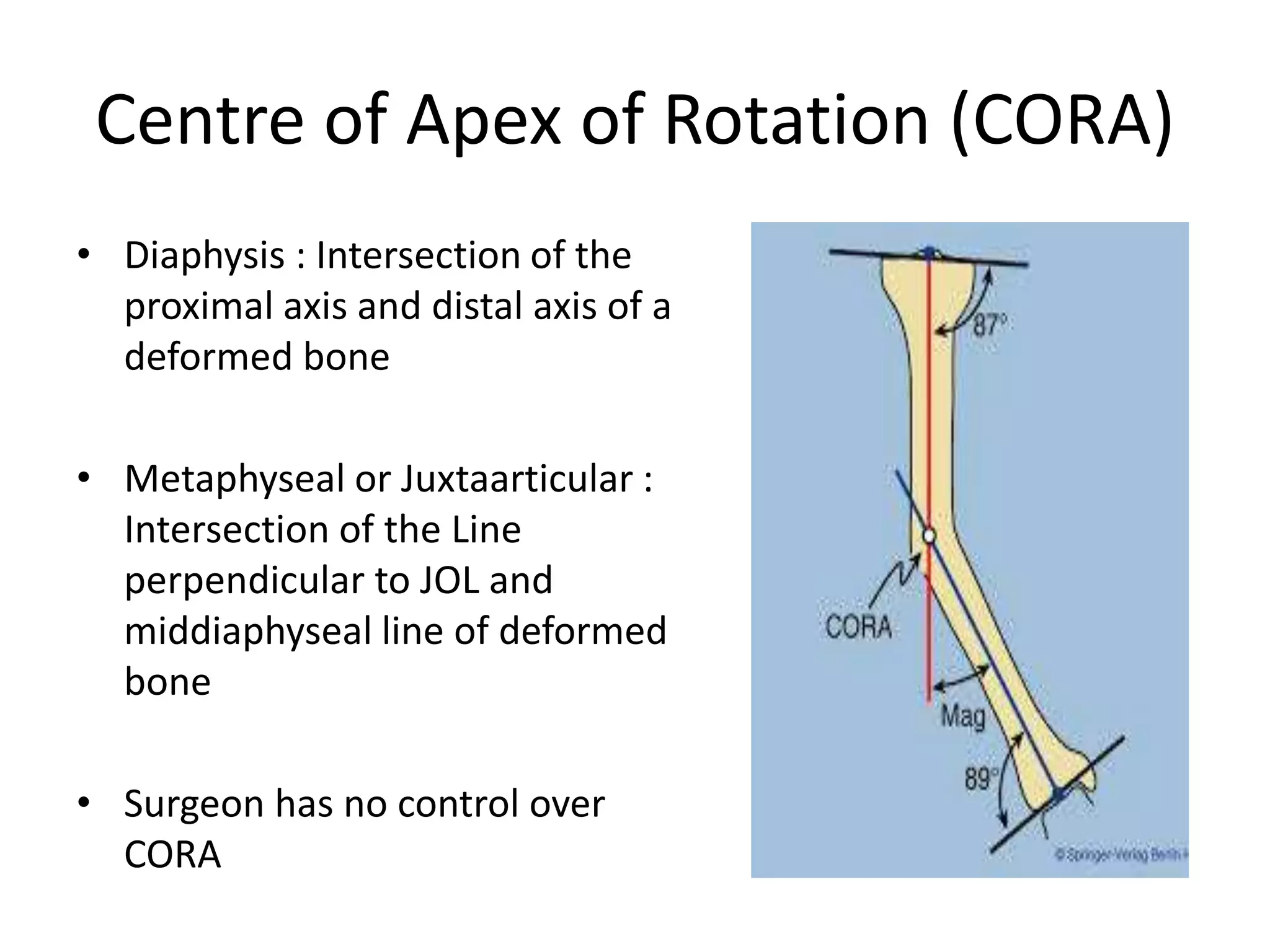 Principle of Deformity Correction in lower Limb | PPTX