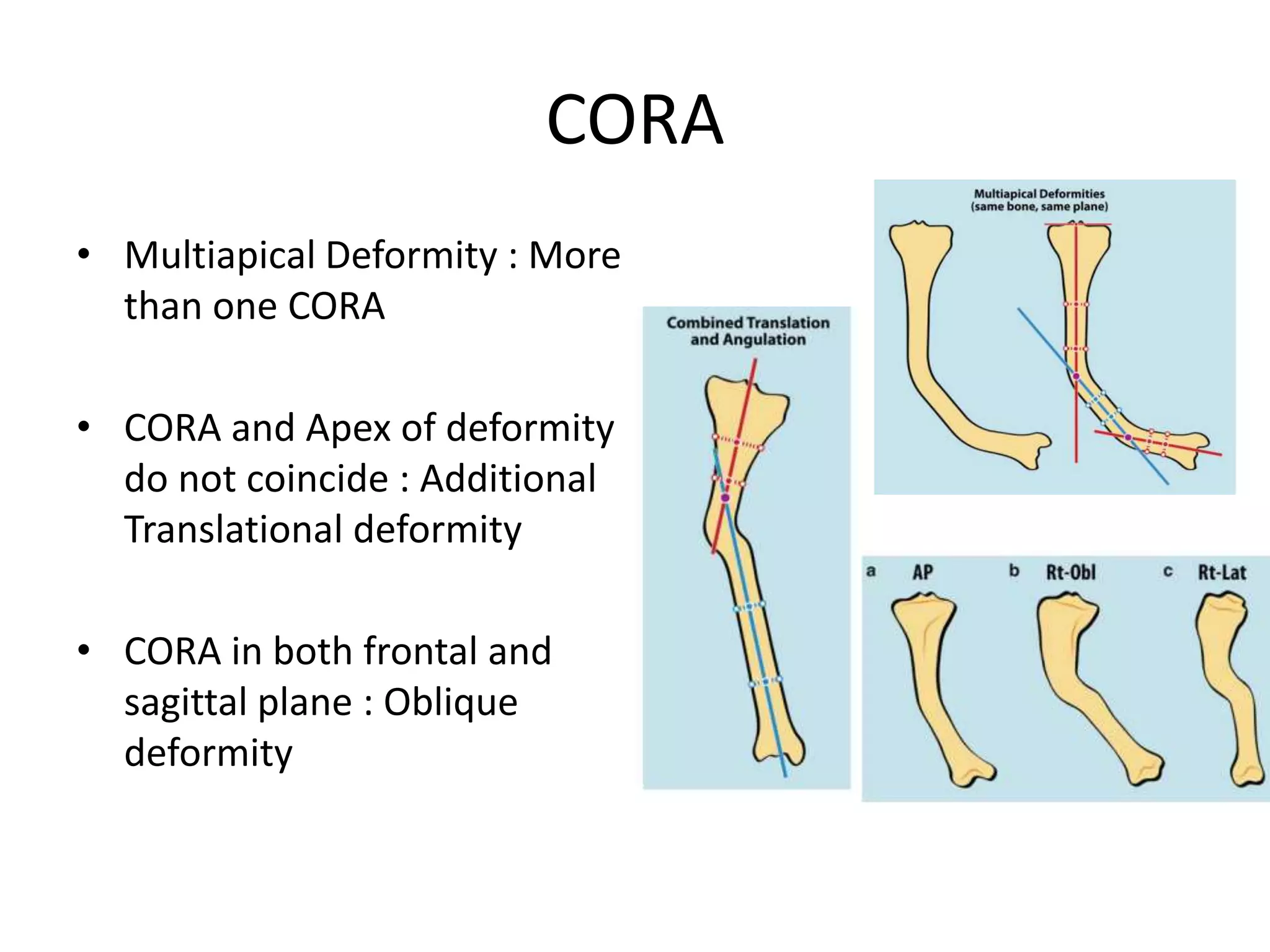 Principle of Deformity Correction in lower Limb | PPTX