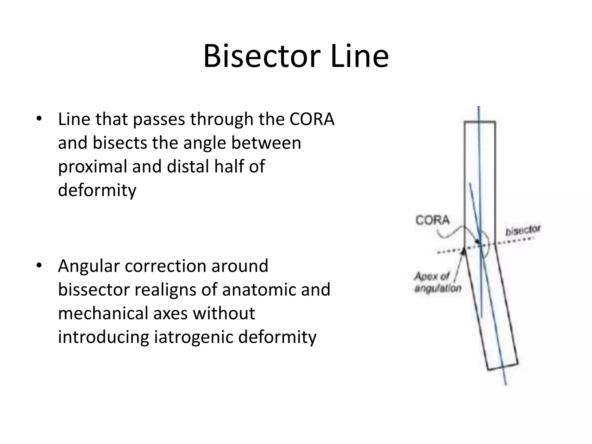 Principle of Deformity Correction in lower Limb | PPTX