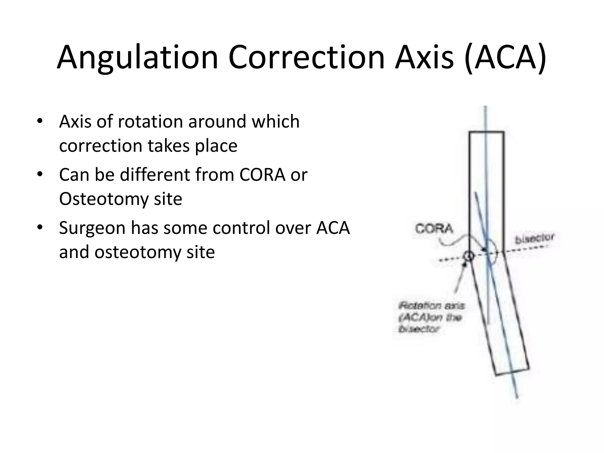 Principle of Deformity Correction in lower Limb | PPTX