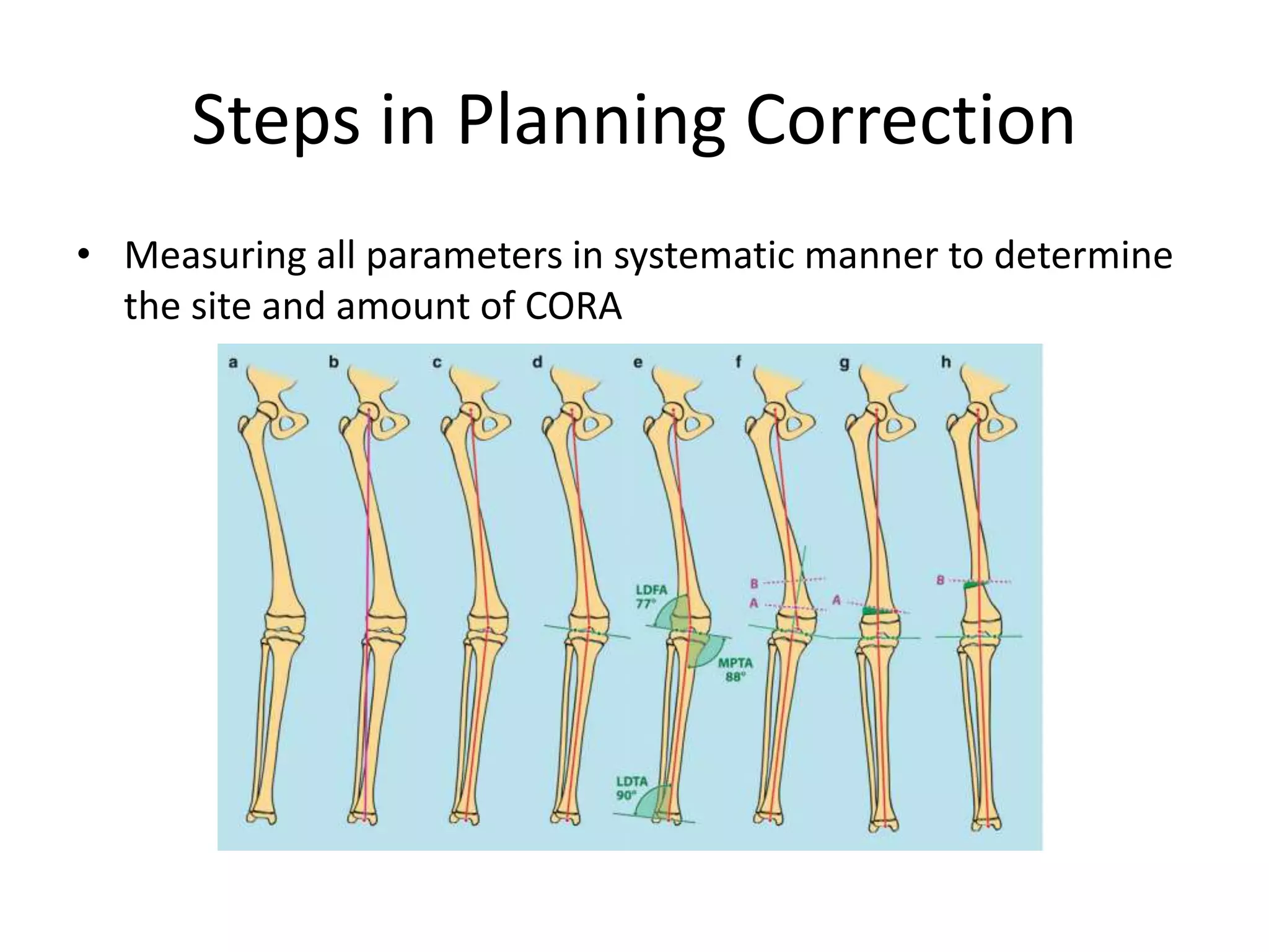 Principle of Deformity Correction in lower Limb | PPTX
