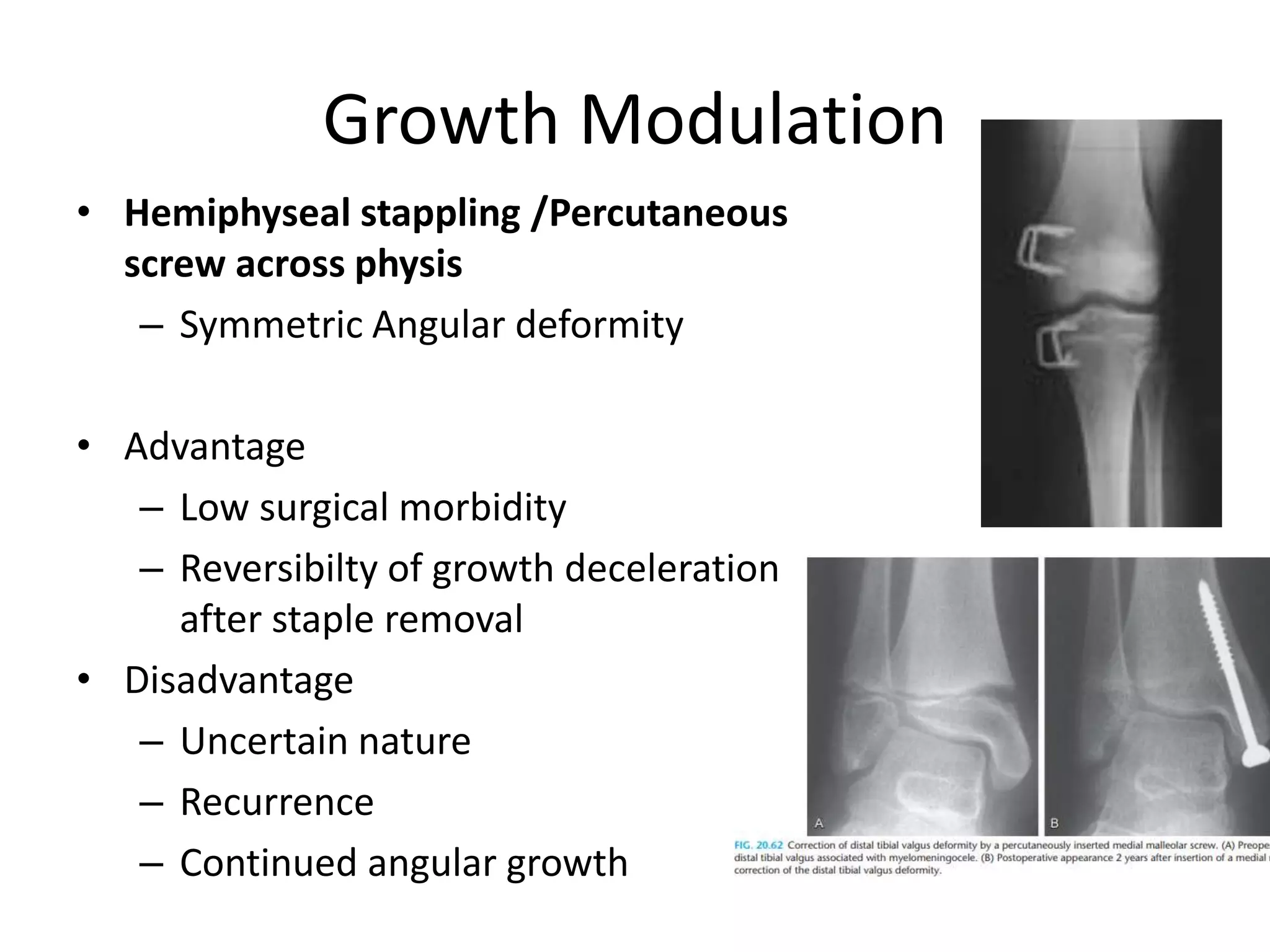 Principle of Deformity Correction in lower Limb | PPTX