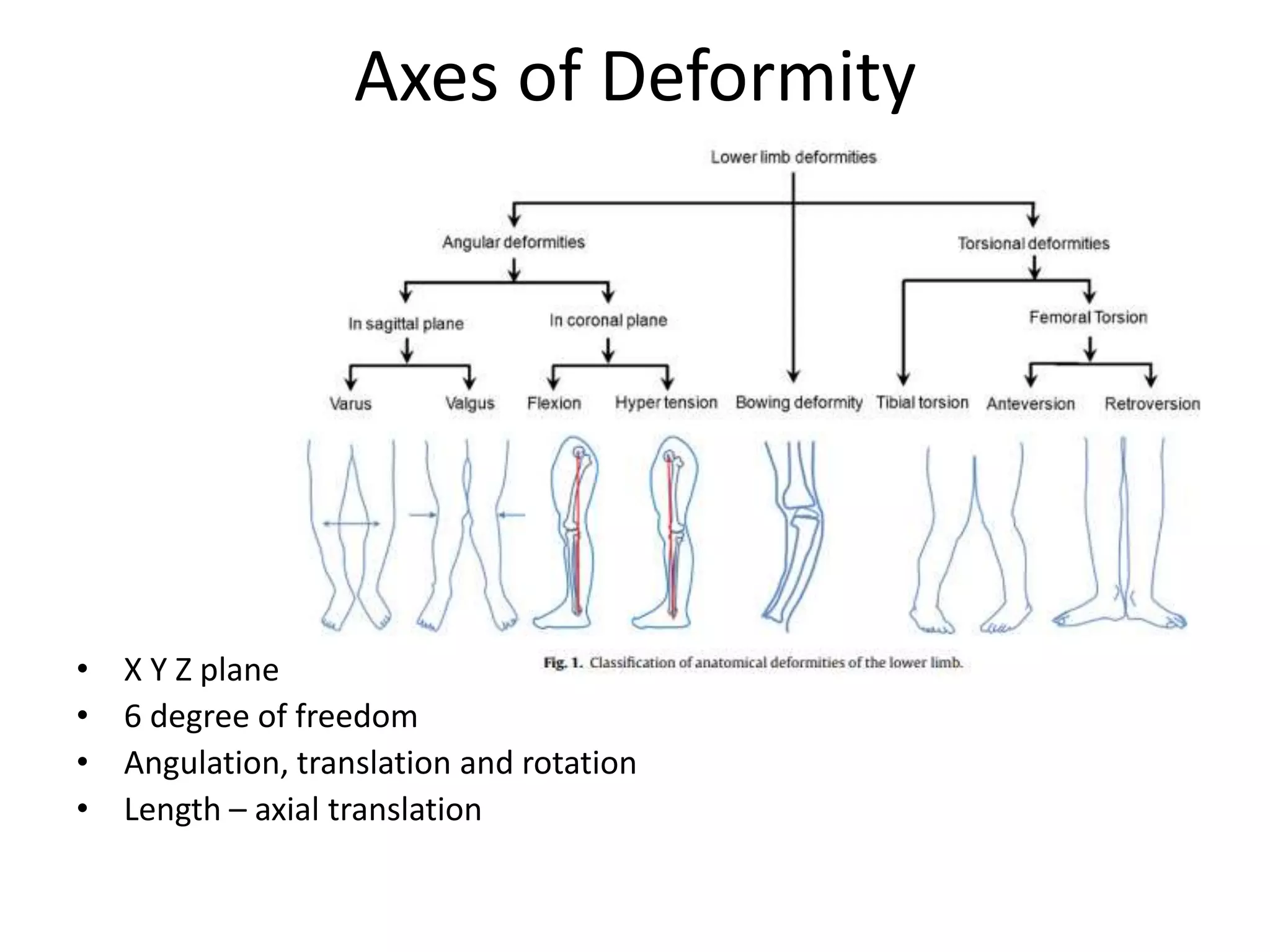 Principle of Deformity Correction in lower Limb | PPTX