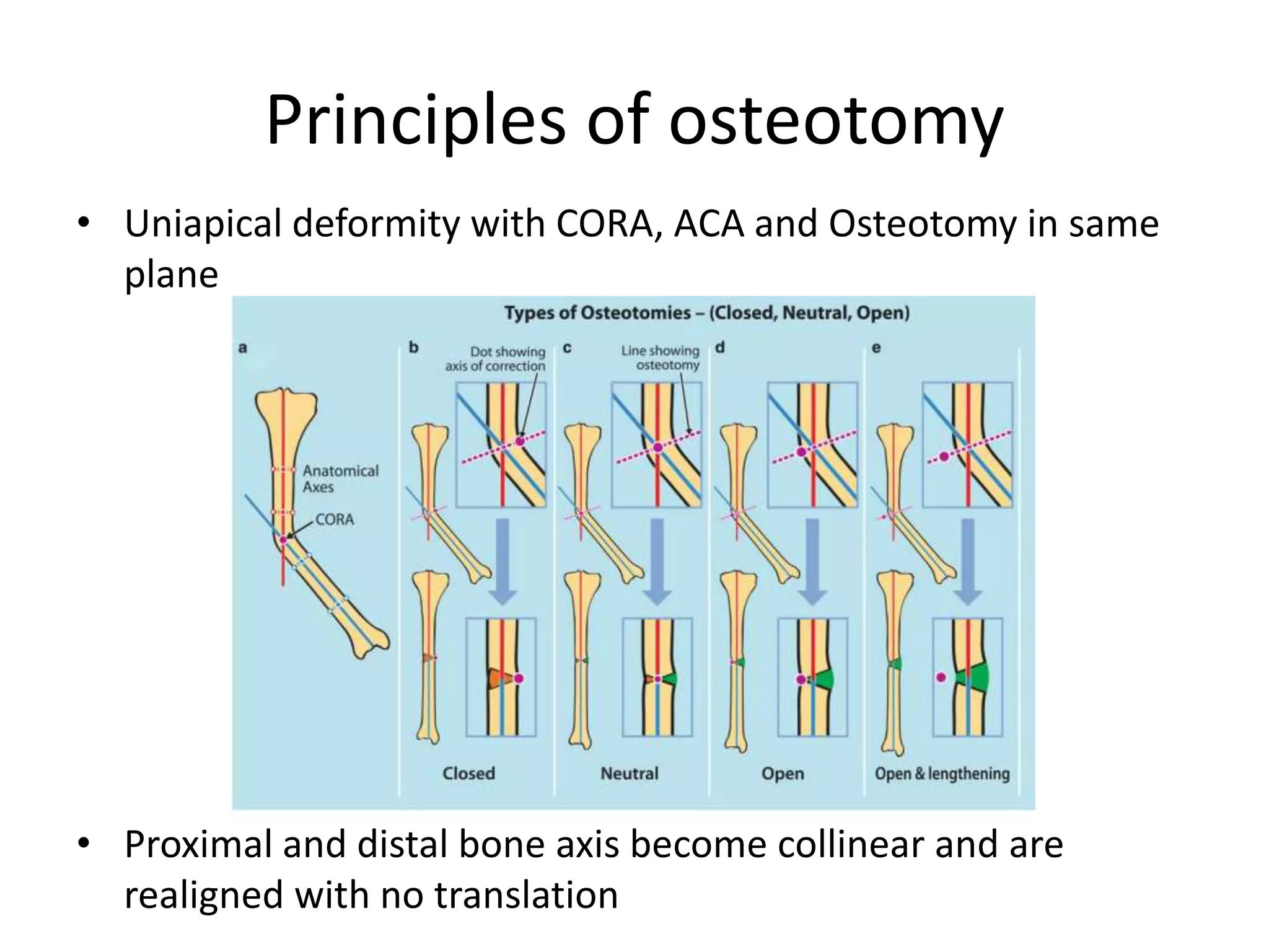 Principle of Deformity Correction in lower Limb | PPTX