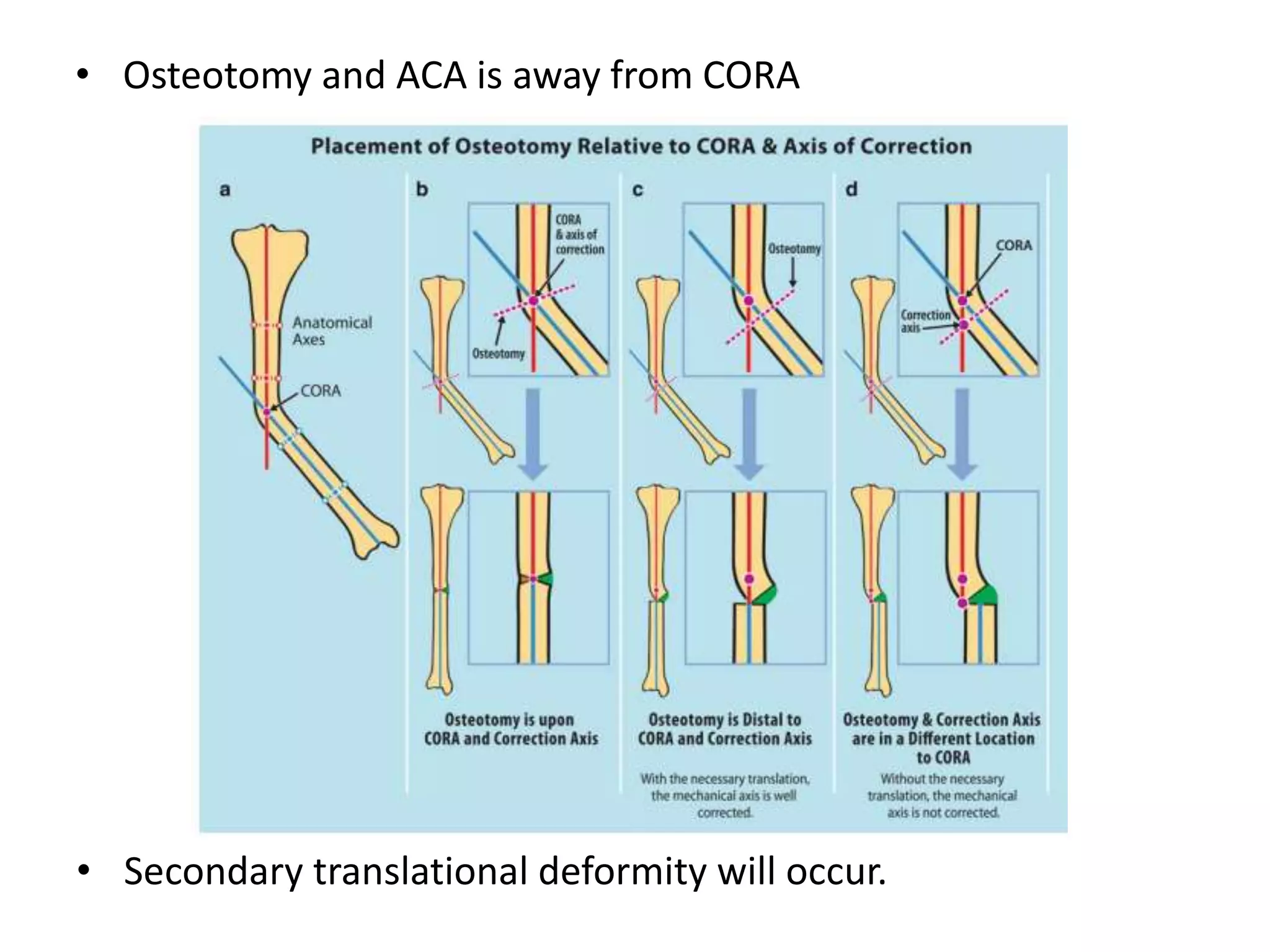 Principle of Deformity Correction in lower Limb | PPTX