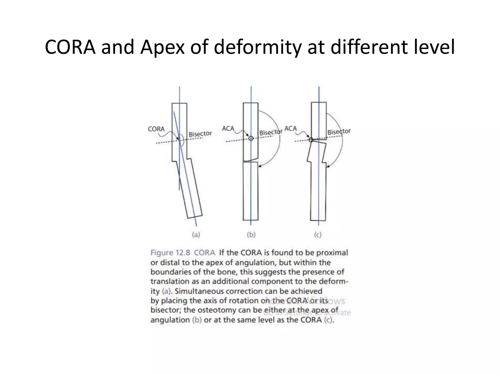 Principle of Deformity Correction in lower Limb | PPTX