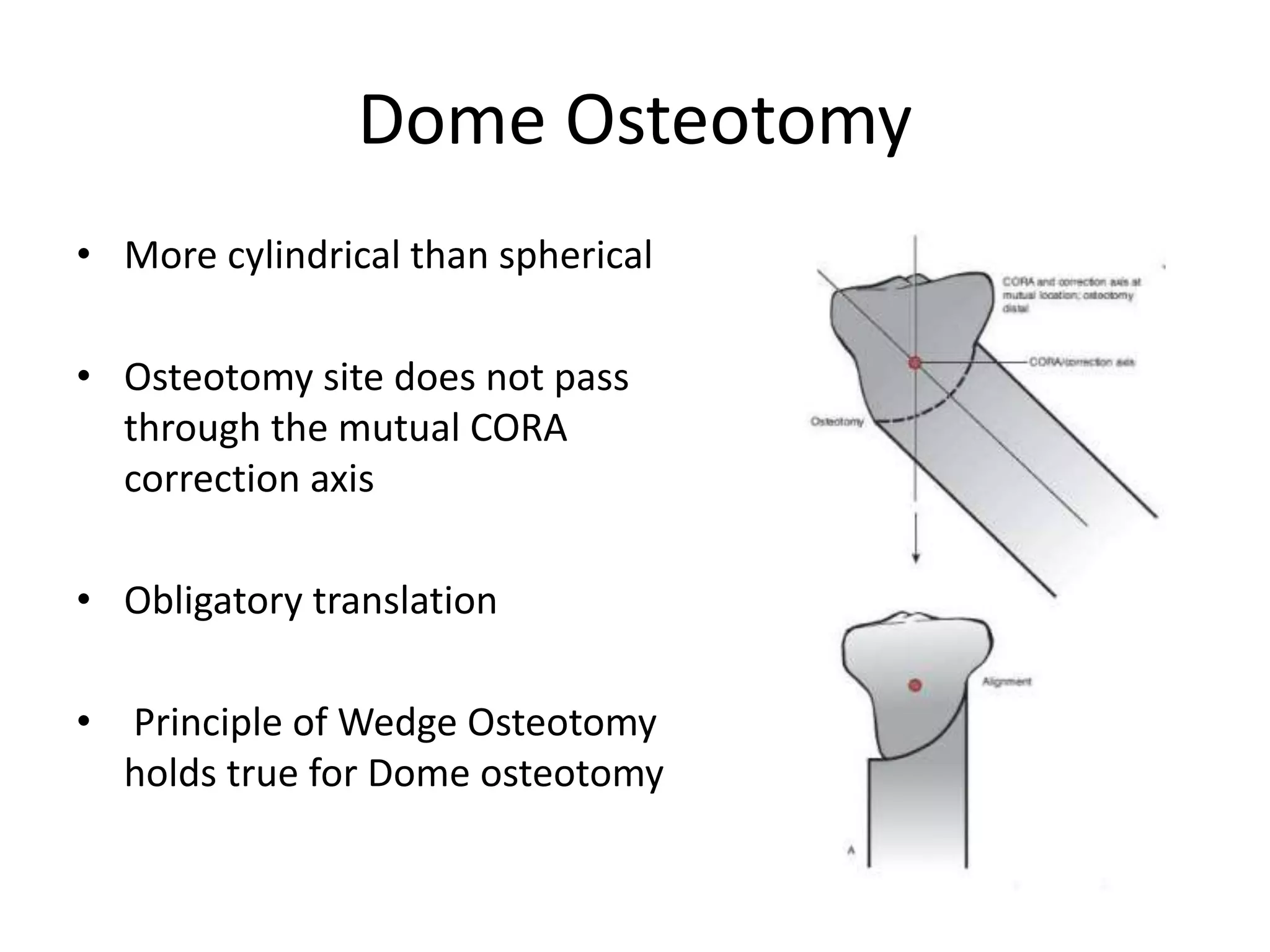 Principle of Deformity Correction in lower Limb | PPTX