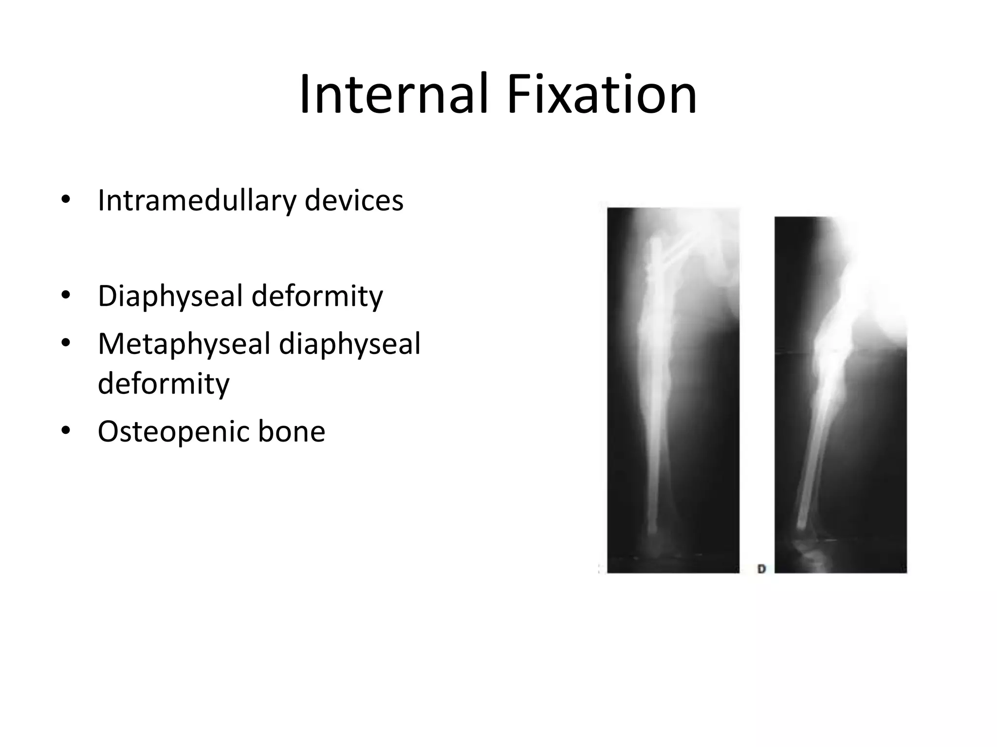 Principle of Deformity Correction in lower Limb | PPTX