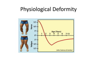 Principle of Deformity Correction in lower Limb | PPTX