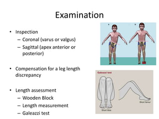 Principle of Deformity Correction in lower Limb | PPTX